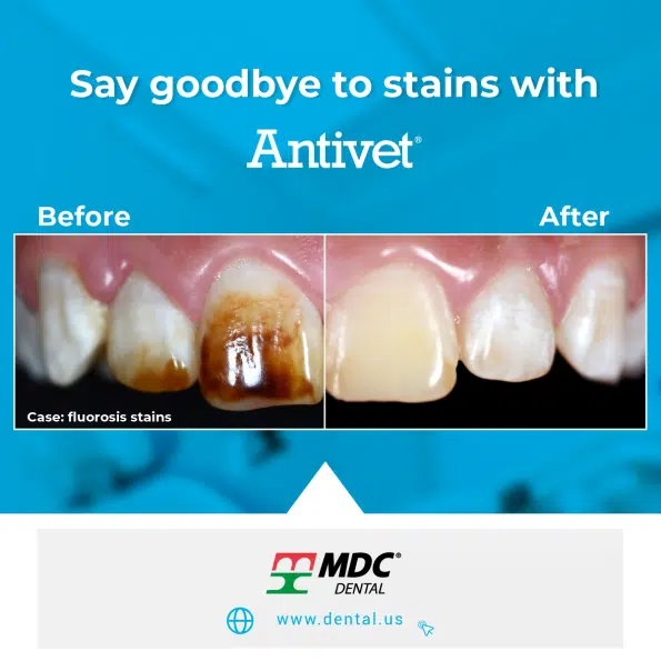 Antivet-Kit - Sedra Dent Solutions